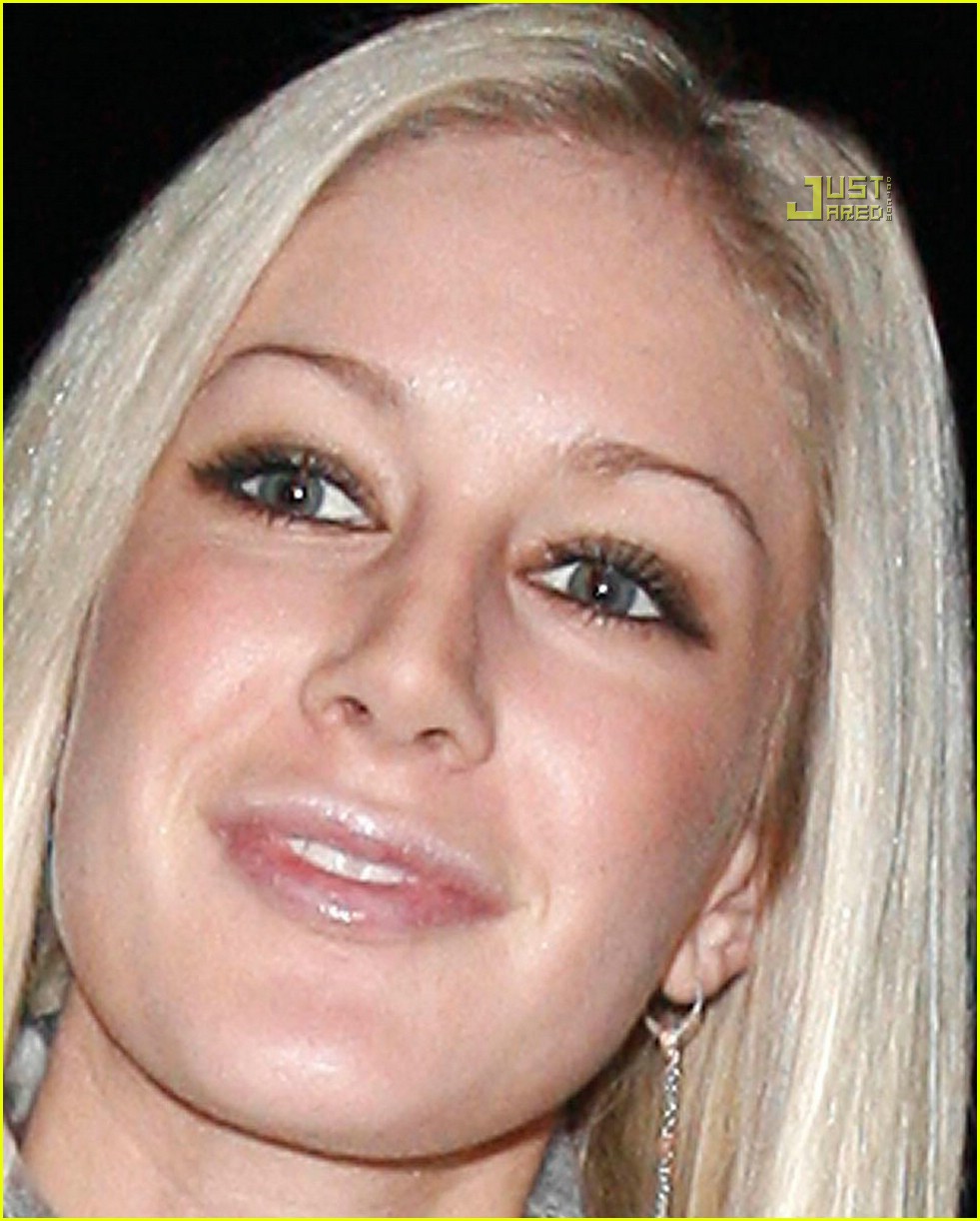 Heidi Montag Has New Lips: Photo 825141 | Photos | Just Jared ...