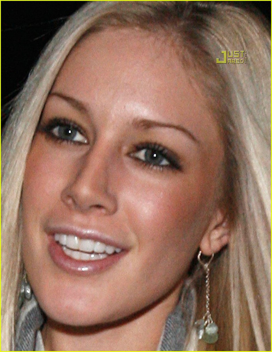 Heidi Montag Has New Lips: Photo 825201 | Photos | Just Jared ...