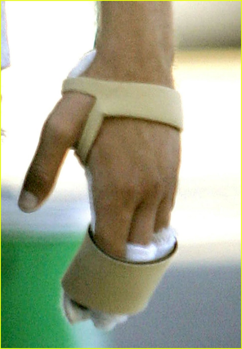 Photo: shia labeouf hand splint 05 | Photo 1335701 | Just Jared ...