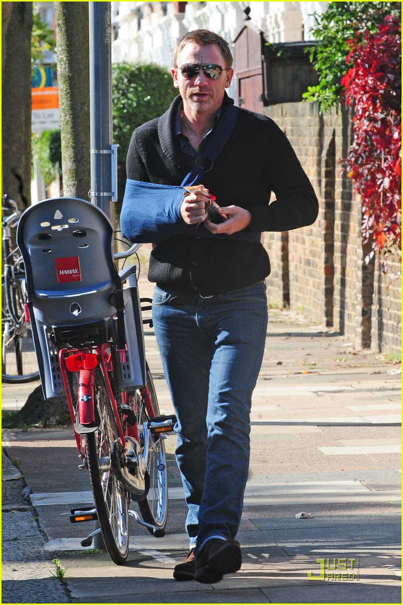 Photo: daniel craig plastic surgery 02 | Photo 1469251 | Just Jared