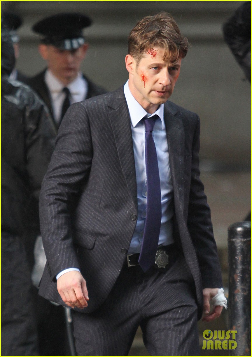 Ben McKenzie Is Bloody On Set After Baby News Reveal: Photo 3476235 ...