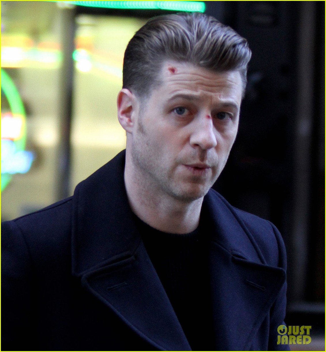 Ben McKenzie Sports Bloody Face During 'Gotham' Filming: Photo 3568146 | Benjamin McKenzie ...