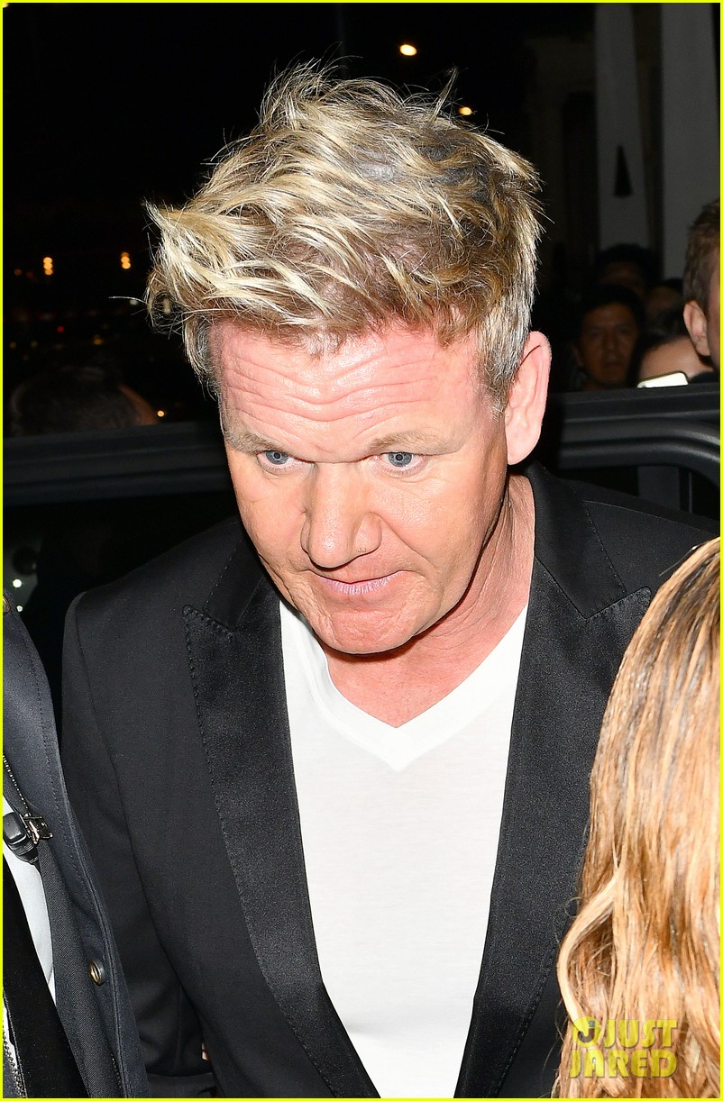 Gordon Beckham Hair