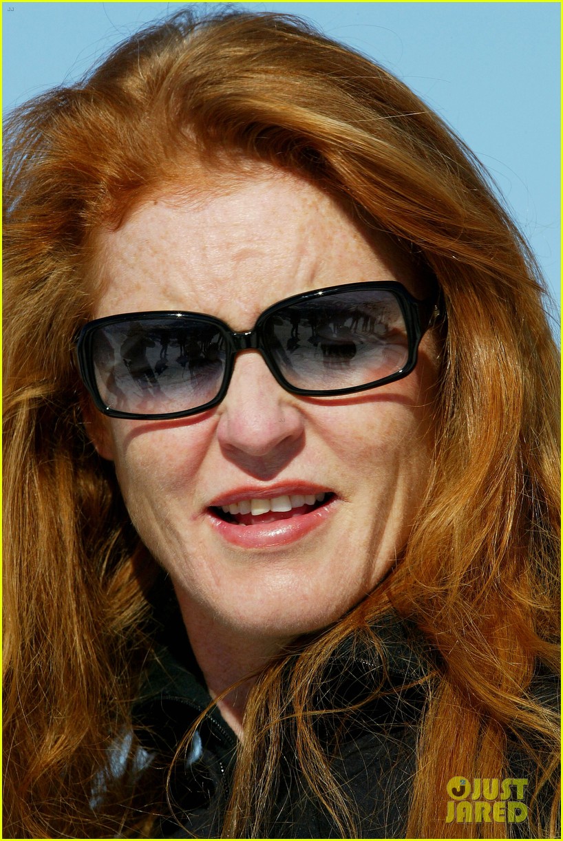 Photo: sarah ferguson reveals plastic surgery procedures 06 | Photo ...