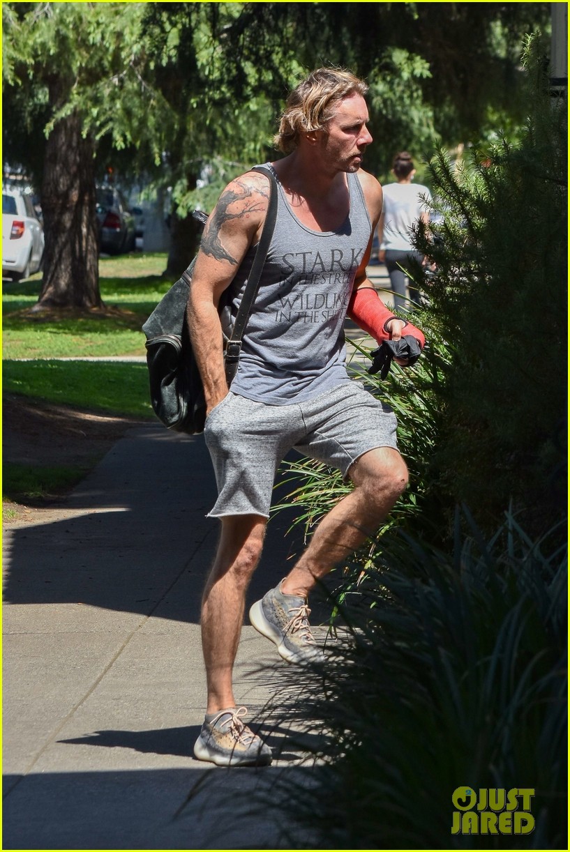Dax Shepard Steps Out in a Cast After Performing Surgery on Himself ...