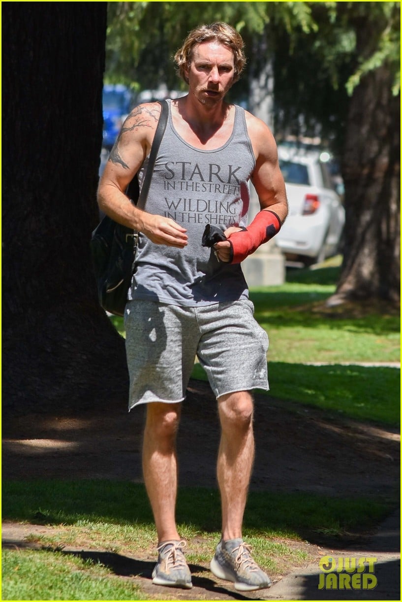 Dax Shepard Steps Out in a Cast After Performing Surgery on Himself ...