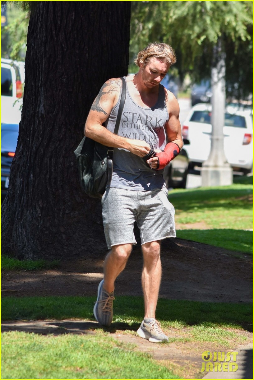 Dax Shepard Steps Out in a Cast After Performing Surgery on Himself ...