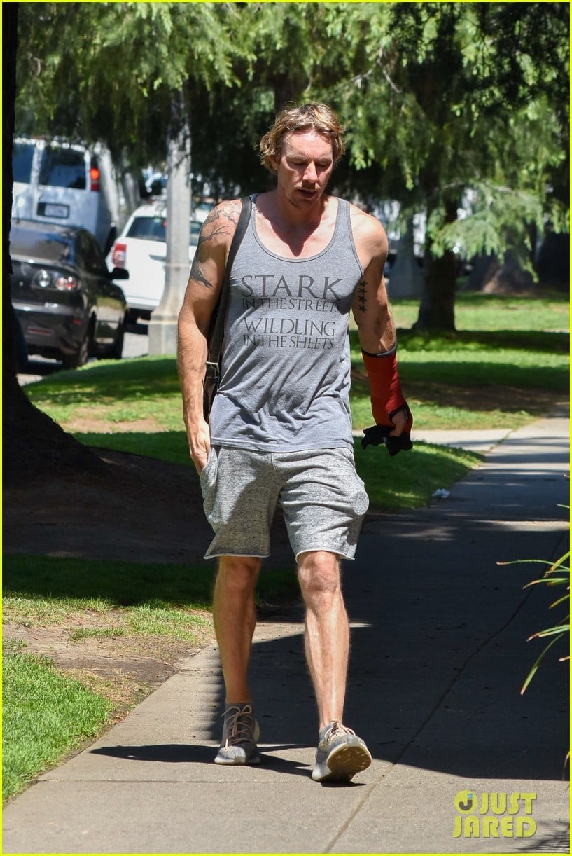 Dax Shepard Steps Out in a Cast After Performing Surgery on Himself ...