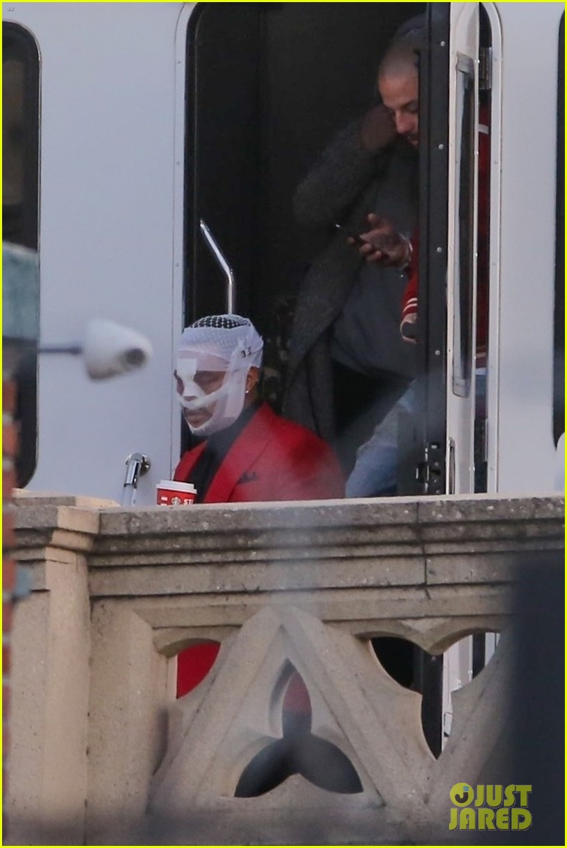 The Weeknd's Head is Covered with Bandages While Filming New Music ...