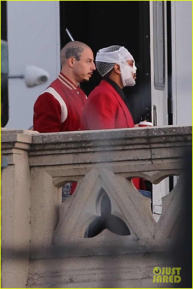 The Weeknd's Head is Covered with Bandages While Filming New Music ...