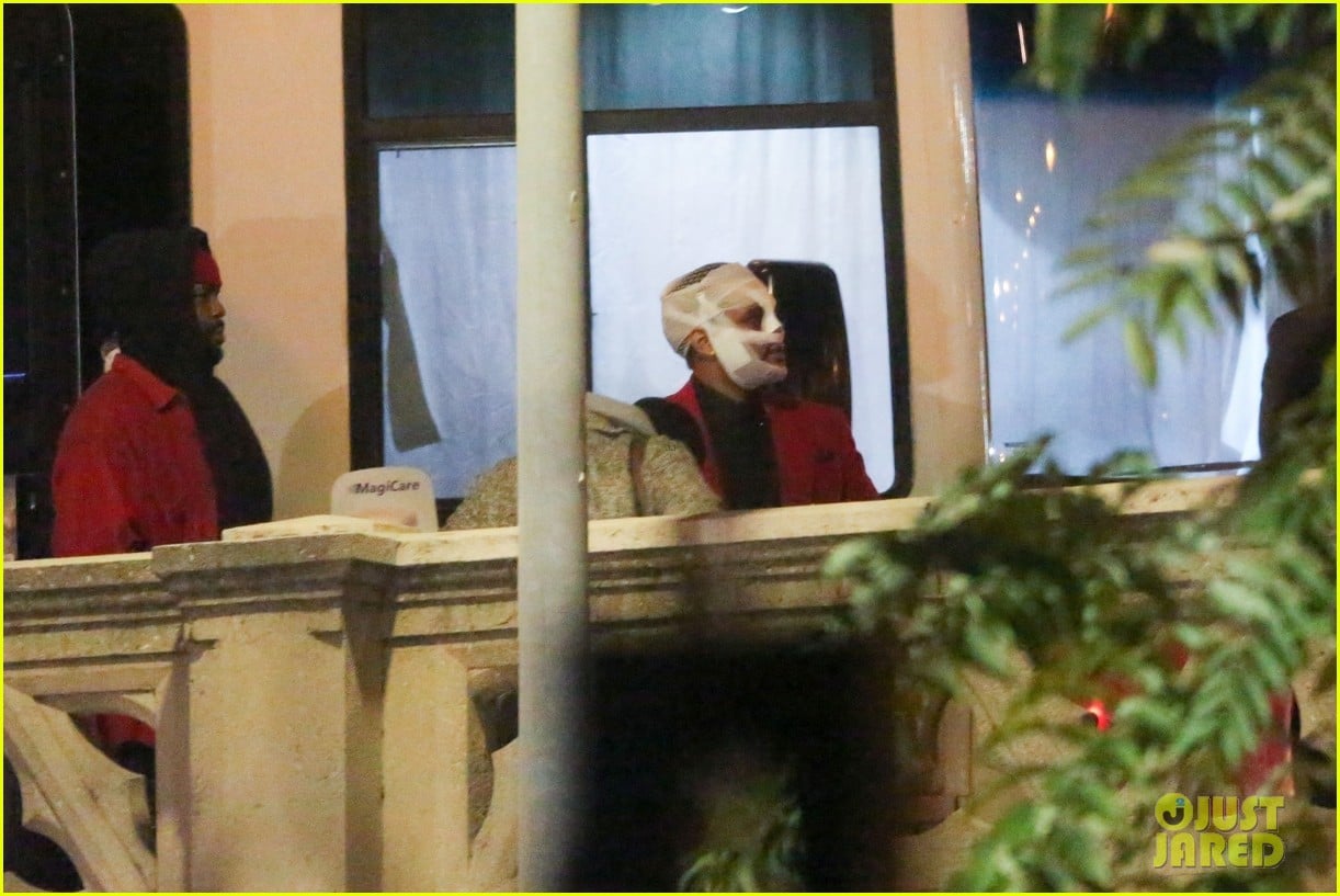 The Weeknd's Head is Covered with Bandages While Filming New Music ...