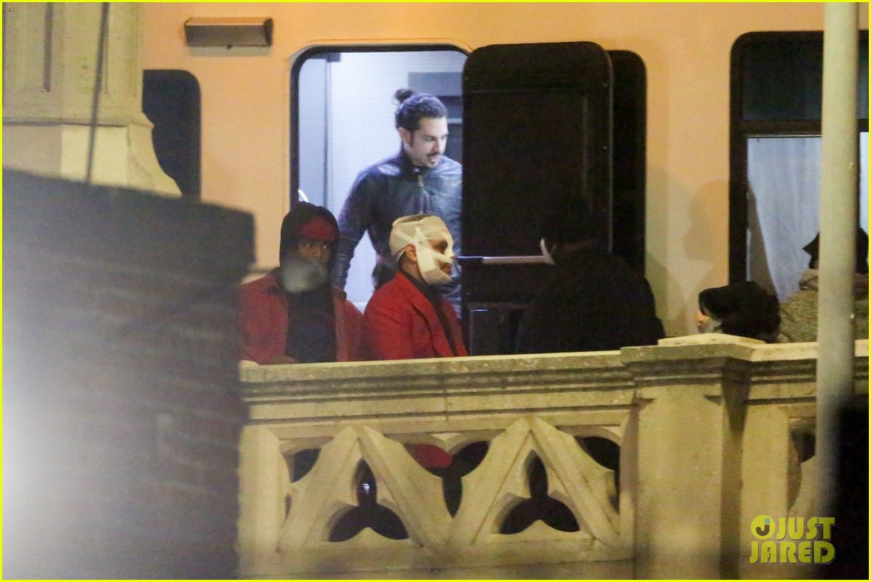 The Weeknd's Head is Covered with Bandages While Filming New Music ...