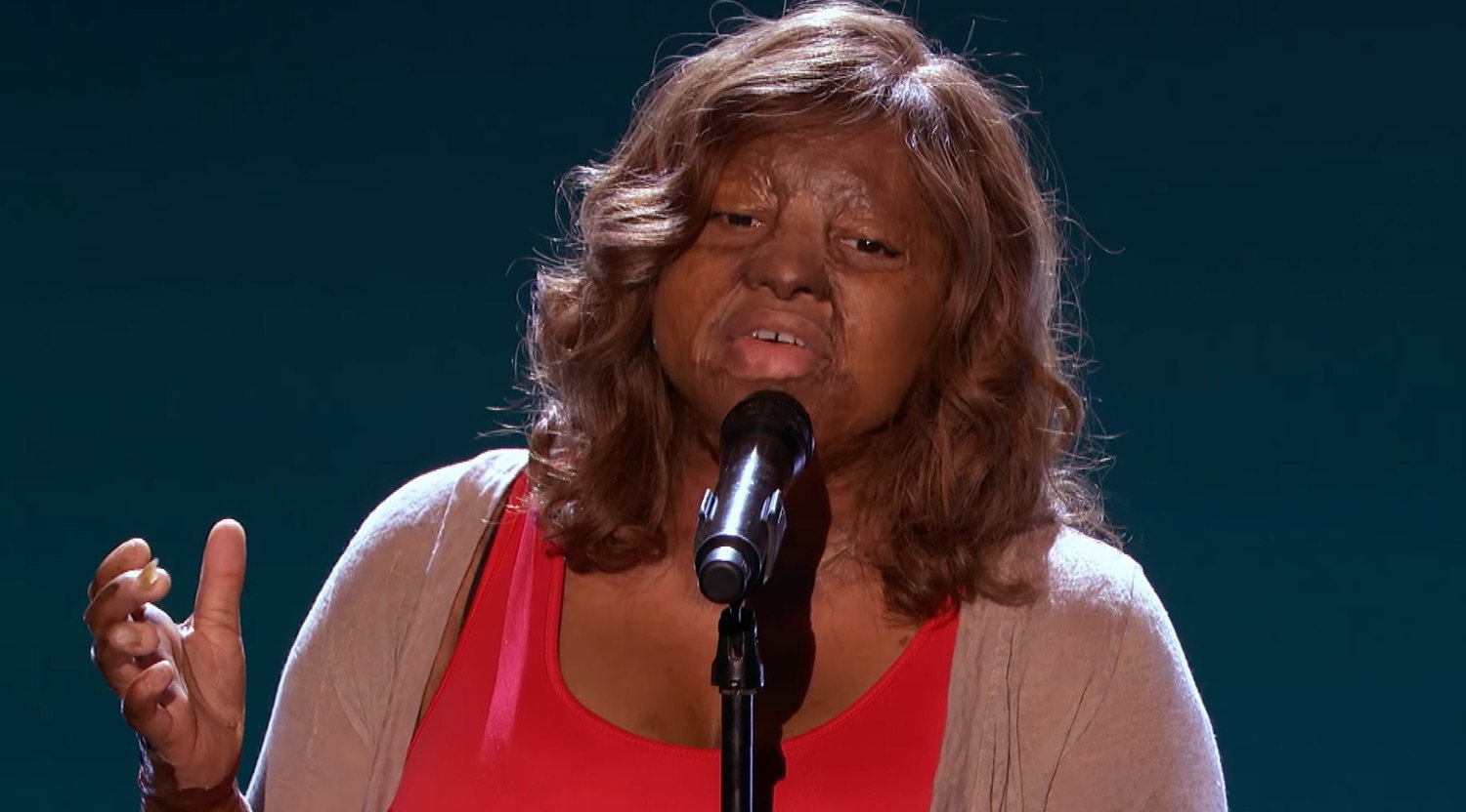 Kechi, a Plane Crash Survivor, Delivers Another Stunning ‘America’s Got ...