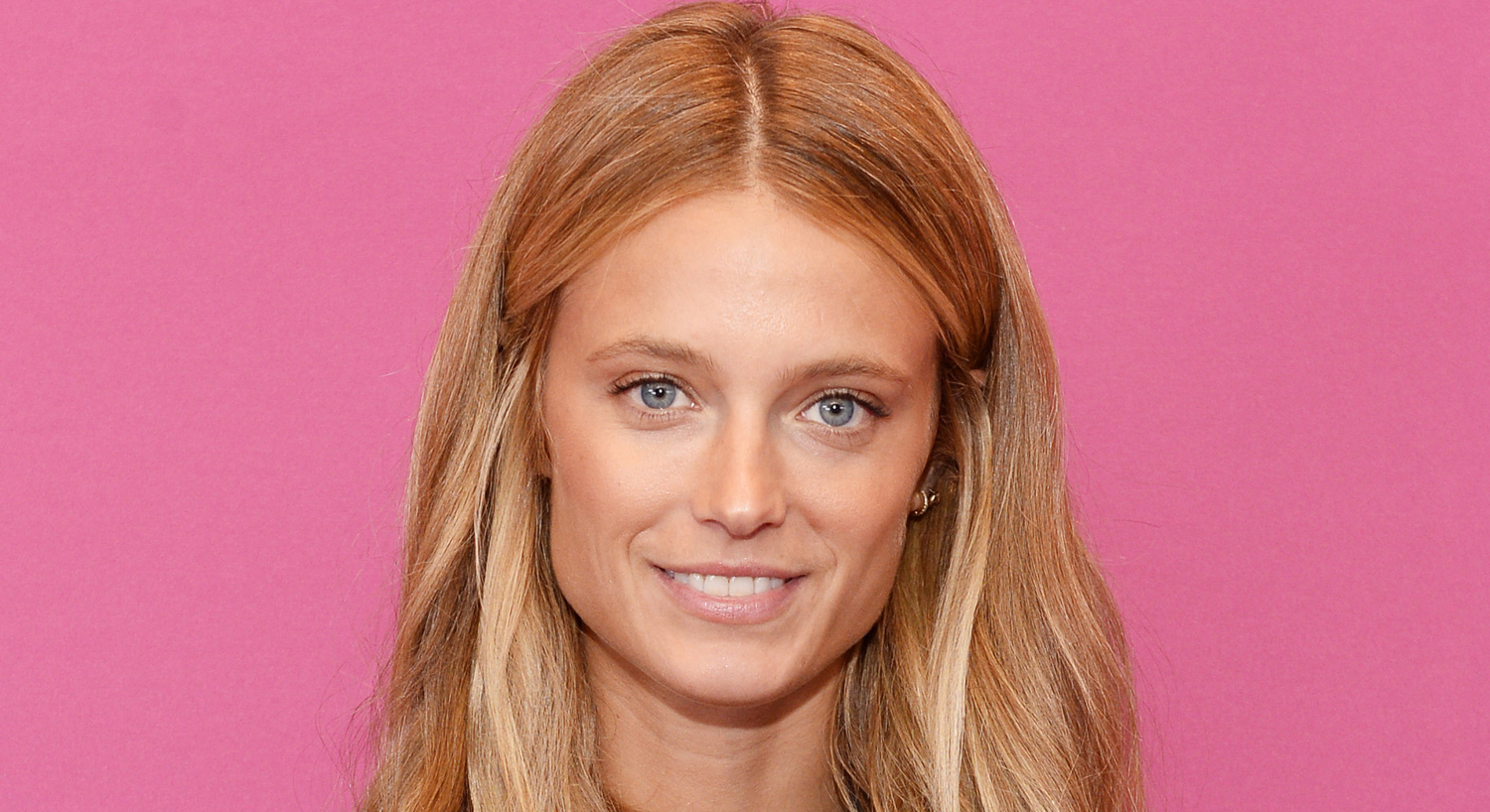 Model Kate Bock Had to Have Her Head Stapled Shut After Rafting ...