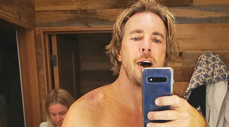 Dax Shepard Says He ‘Needs Surgery’ After Motorcycle Accident | Dax ...